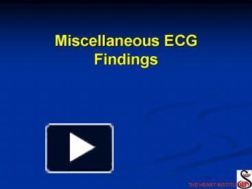 PPT – Miscellaneous ECG Findings PowerPoint presentation | free to view ...