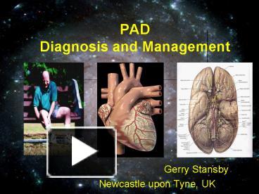 PAD Diagnosis and Management presentation | free to download