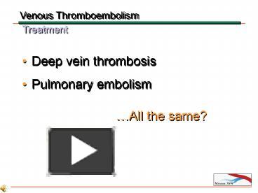Deep vein thrombosis presentation | free to view