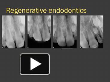 Regenerative endodontics presentation | free to download