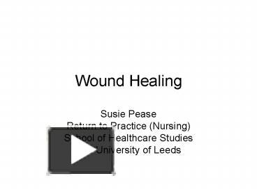 Wound Healing presentation | free to view
