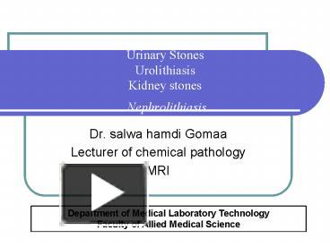 Urinary Stones Urolithiasis Kidney stones Nephrolithiasis presentation ...