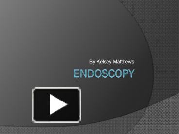 Endoscopy presentation | free to download
