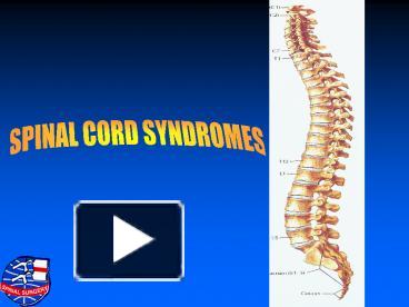 SPINAL CORD SYNDROMES presentation | free to view