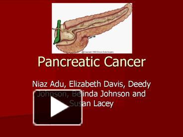 PPT – Pancreatic Cancer PowerPoint presentation | free to view - id ...