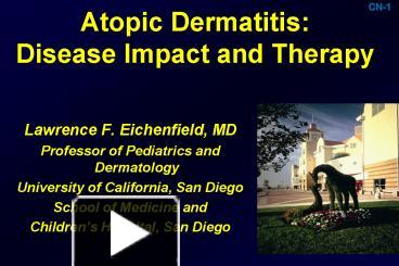 Atopic Dermatitis: Disease Impact and Therapy presentation | free to view