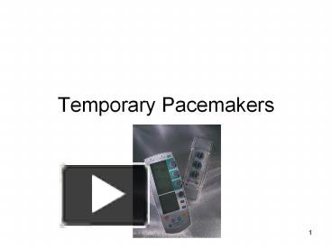 Temporary Pacemakers presentation | free to download