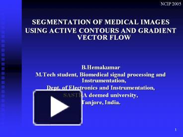 SEGMENTATION OF MEDICAL IMAGES presentation | free to download