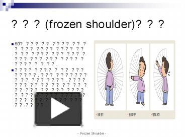frozen shoulder)??? presentation | free to download