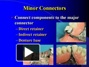 PPT – Minor Connectors PowerPoint presentation | free to view - id ...