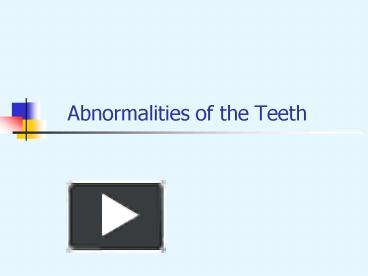 Abnormalities of the Teeth presentation | free to view