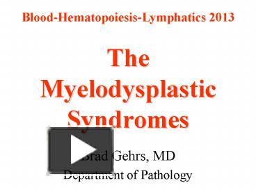 The Myelodysplastic Syndromes presentation | free to view