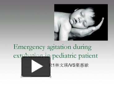 Emergency agitation during extubation in pediatric patient presentation ...
