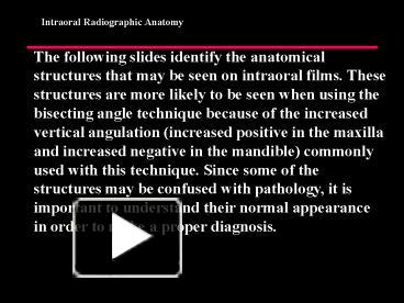 PPT – Intraoral Radiographic Anatomy PowerPoint presentation | free to ...