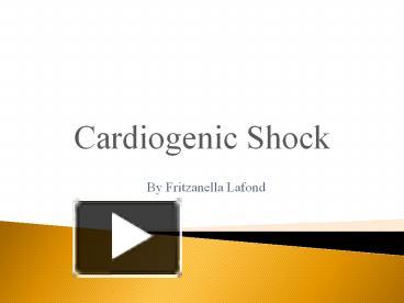 Cardiogenic Shock presentation | free to view