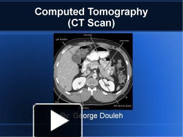 Computed Tomography (CT Scan) presentation | free to download