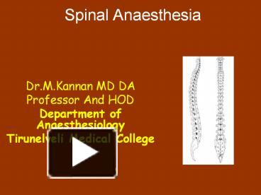 PPT – Spinal Anaesthesia PowerPoint presentation | free to download ...
