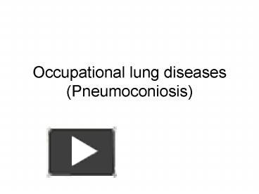 Occupational lung diseases (Pneumoconiosis) presentation | free to view