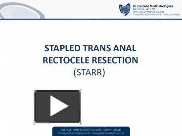 PPT – STAPLED TRANS ANAL RECTOCELE RESECTION (STARR) PowerPoint ...