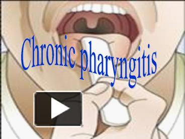 Chronic pharyngitis presentation | free to view