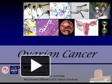 Ovarian Cancer presentation | free to view