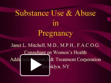 Substance Use presentation | free to view