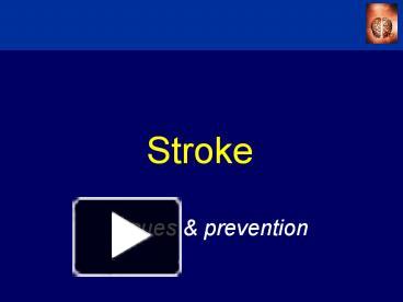 Stroke presentation | free to download