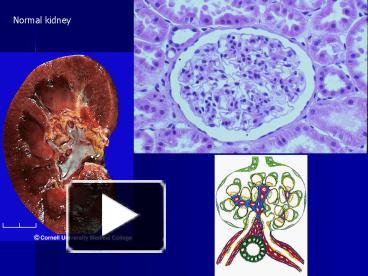 Normal kidney presentation | free to view