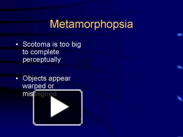 PPT – Metamorphopsia PowerPoint presentation | free to view - id: 4bae4 ...