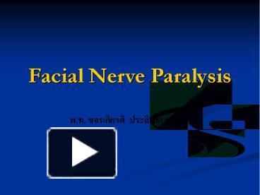 Facial Nerve Paralysis presentation | free to view
