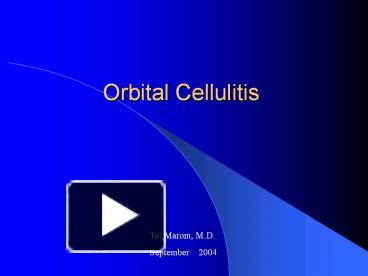 Orbital Cellulitis presentation | free to download
