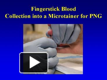 PPT – Fingerstick Blood Collection into a Microtainer for PNG ...