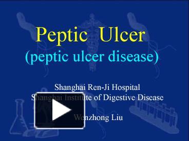 PPT – Peptic Ulcer PowerPoint presentation | free to view - id: 4cb57c ...
