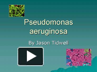 Pseudomonas aeruginosa presentation | free to view