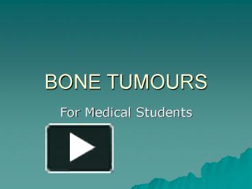 PPT – BONE TUMOURS PowerPoint presentation | free to view - id: 4cf5f3 ...