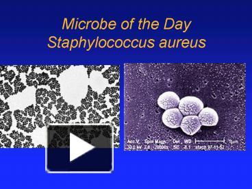PPT – Microbe of the Day Staphylococcus aureus PowerPoint presentation ...