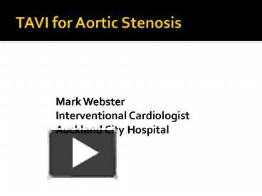 TAVI for Aortic Stenosis presentation | free to view