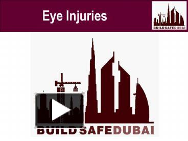 Eye Injuries presentation | free to view