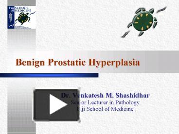 PPT – Benign Prostatic Hyperplasia PowerPoint presentation | free to ...