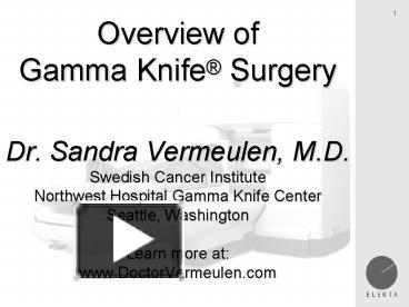 PPT – Overview of Gamma Knife PowerPoint presentation | free to ...