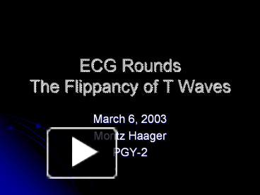 ECG Rounds The Flippancy of T Waves presentation | free to download