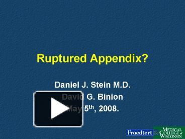 Ruptured Appendix presentation | free to view