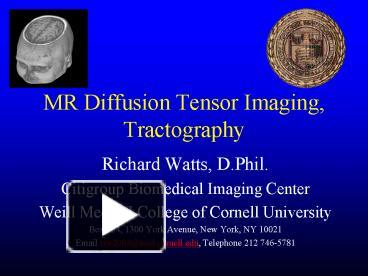 PPT – MR Diffusion Tensor Imaging, Tractography PowerPoint presentation ...