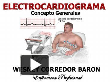 ELECTROCARDIOGRAMA presentation | free to download