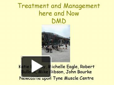 Treatment and Management here and Now DMD presentation | free to view