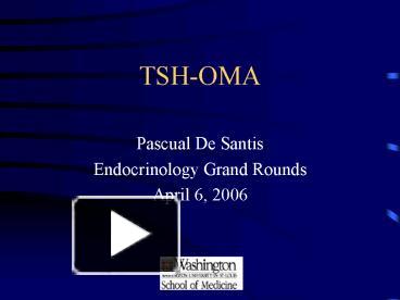 TSHOMA presentation | free to view