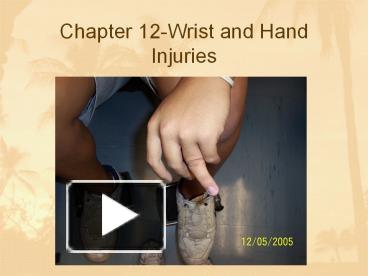 PPT – Chapter 12-Wrist and Hand Injuries PowerPoint presentation | free ...