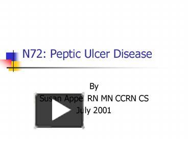 PPT – N72: Peptic Ulcer Disease PowerPoint presentation | free to view ...