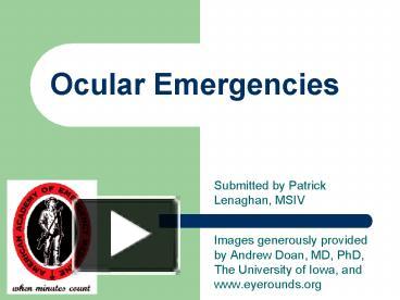 Ocular Emergencies presentation | free to view