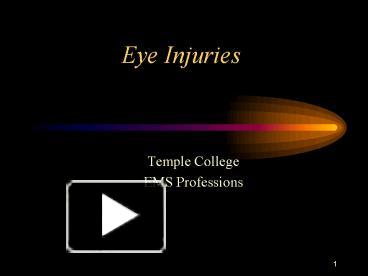 PPT – Eye Injuries PowerPoint presentation | free to view - id: 5588ca ...
